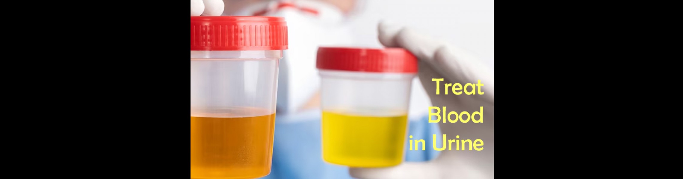 Treat Blood Urine in Cats